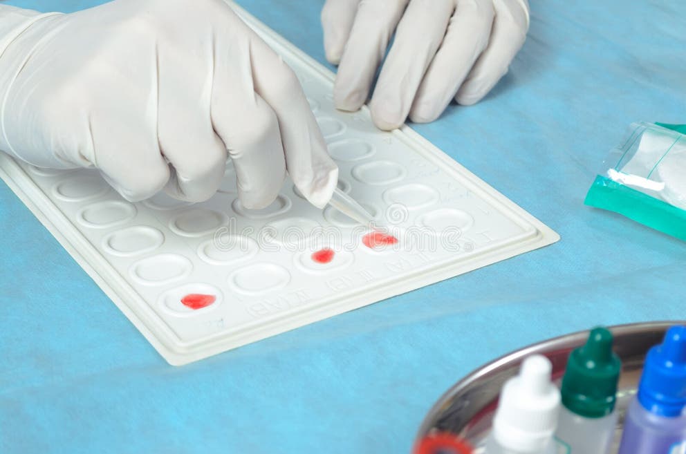 Blood Group and Rh Factor Testing Stock Photo - Image of immunology ...