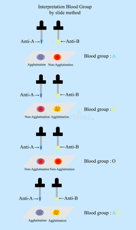 Abo Blood Group System Stock Illustrations – 24 Abo Blood Group System ...