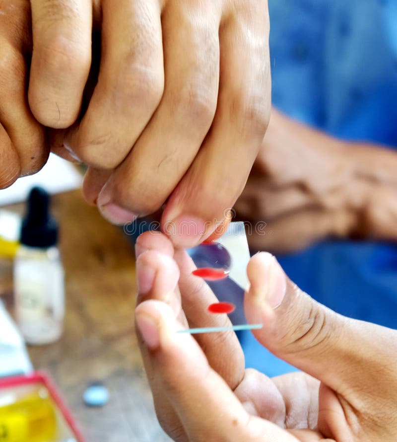 Blood Group Tasting, Blood Grouping, Blood Group and Rh Factor Testing ...