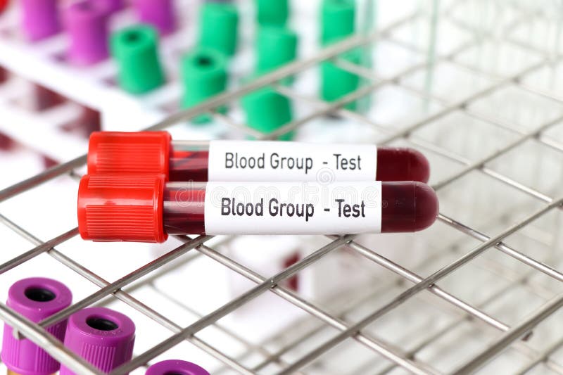 Blood Group Test, Blood Sample To Analyze in the Laboratory Stock Image ...