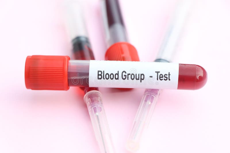 Blood Group Test, Blood Sample To Analyze in the Laboratory Stock Photo ...
