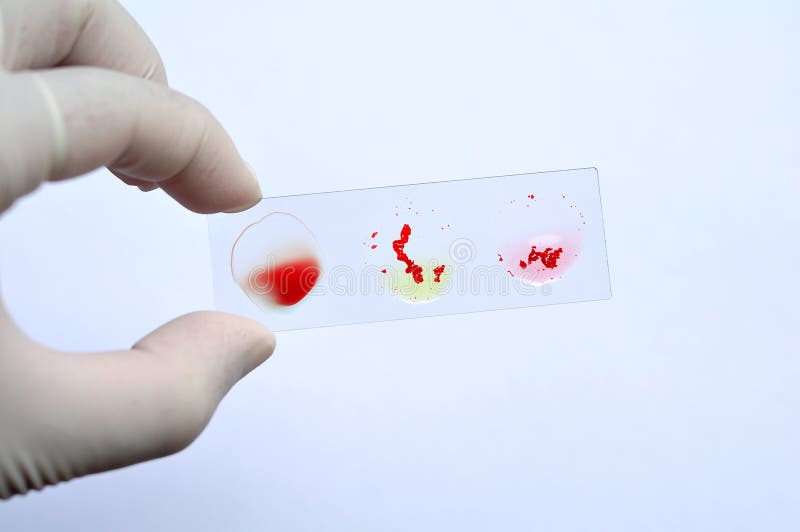 Blood group testing stock photo. Image of laboratory - 21141498