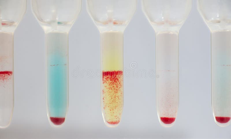 Blood Group ABO Typing Gel Test Stock Photo - Image of diagram ...