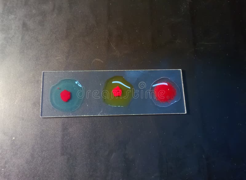 Blood Group Testing by Slide Agglutination Method, ABO Stock Image ...