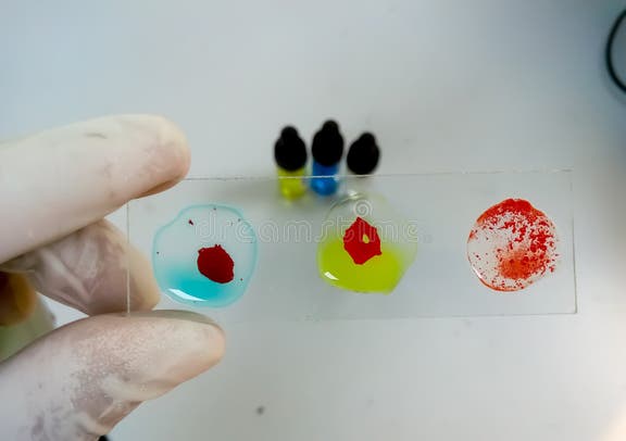 Blood Group Testing by Slide Agglutination Method. Blood Grouping Stock ...