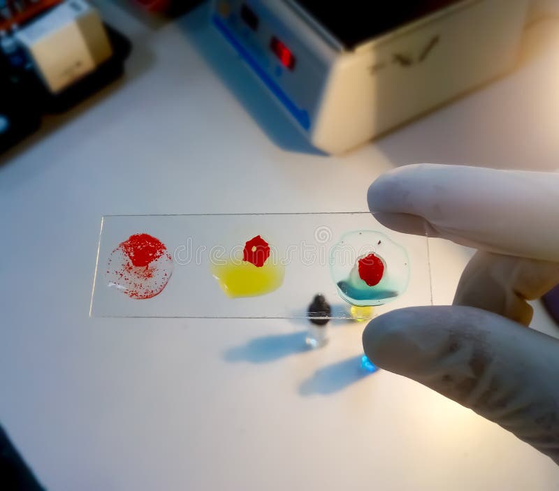 Blood Grouping Testing by Slide Agglutination Method. Blood Grouping ...