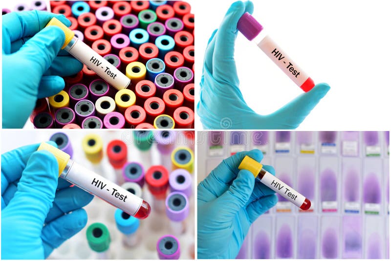 Blood for HIV test stock photo. Image of biology, test - 108465976