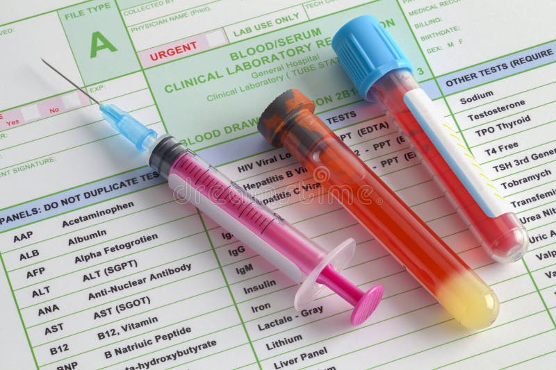 Blood Lab Work stock image. Image of haematology, innovation - 69003559
