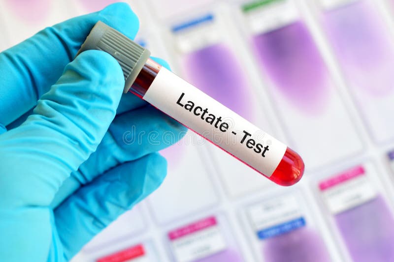 Blood for lactate test stock image. Image of failure - 113244685