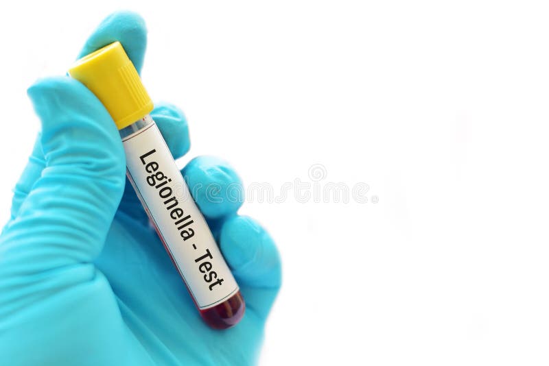 Blood for Legionella test stock image. Image of legionellosis - 109343611