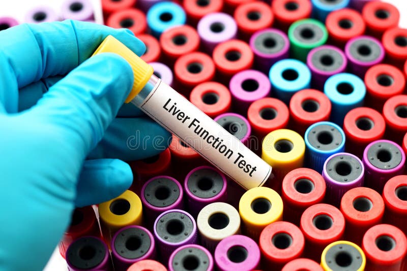 Blood for Liver Function Test Stock Photo - Image of phosphatase ...