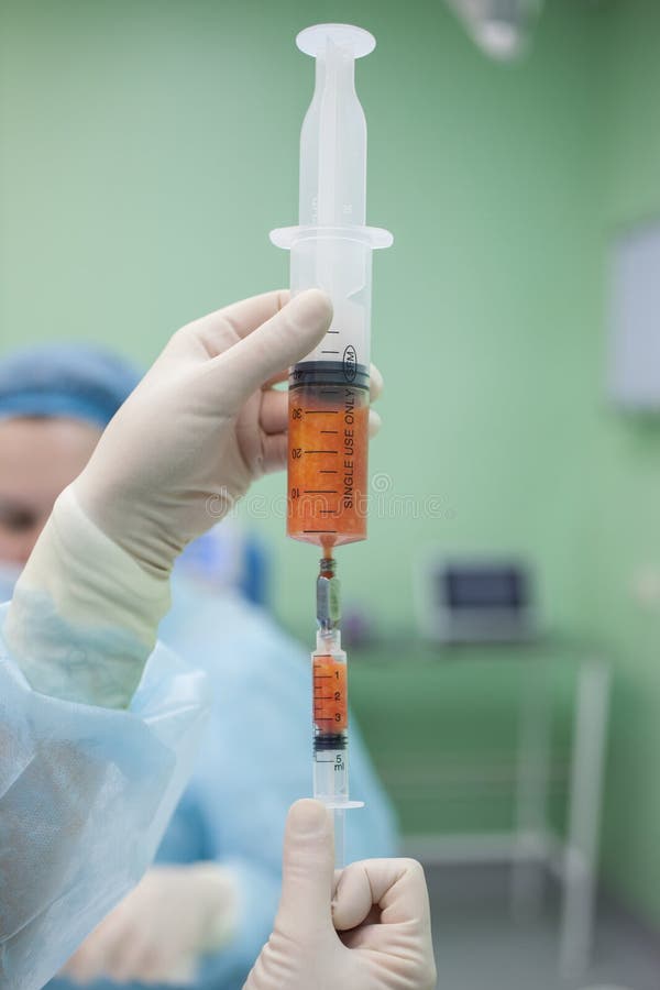 Blood Plasma in Cosmetic Medicine Stock Image - Image of bloodcare ...