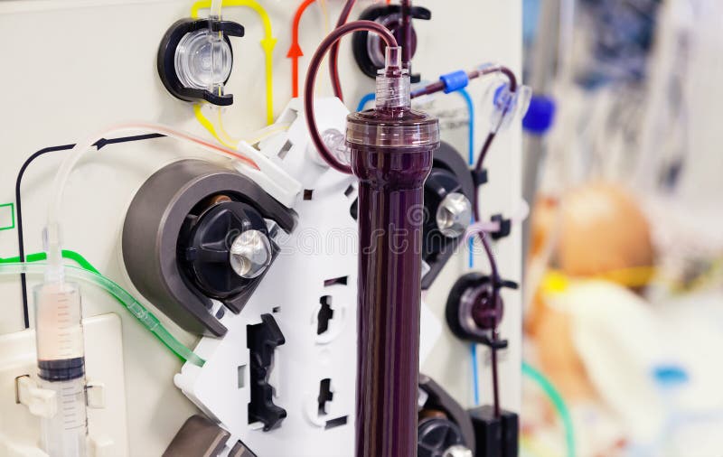 Blood Purification System In Human Body at Otto Atkinson blog