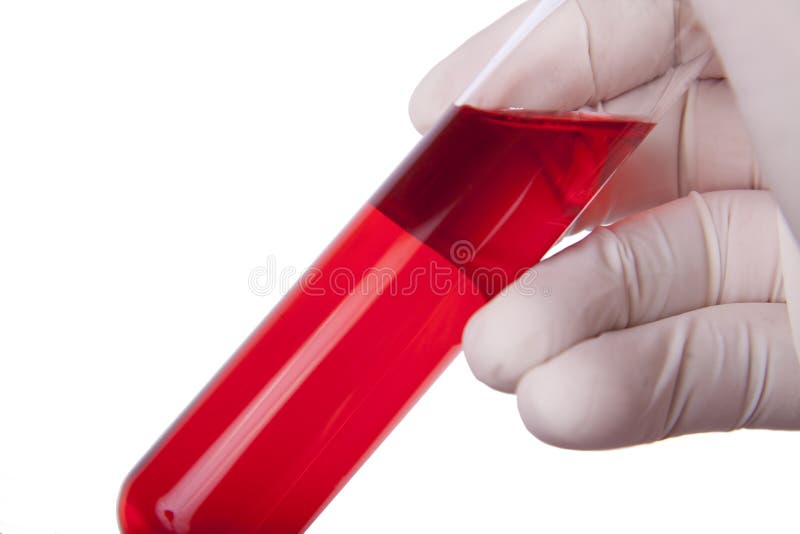 Blood sample stock photo. Image of chemical, analysis - 11241276