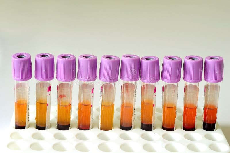 Blood Sample Picture. Image: 20636935