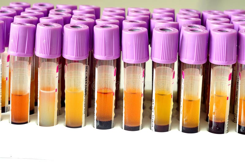 Blood sample stock image. Image of chemistry, laboratory - 20637075