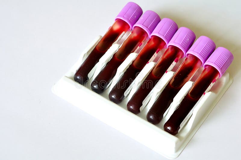 Blood sample stock image. Image of science, experiment - 20637367