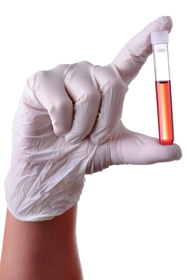Blood Sample stock photo. Image of plasma, health, isolated - 21026840