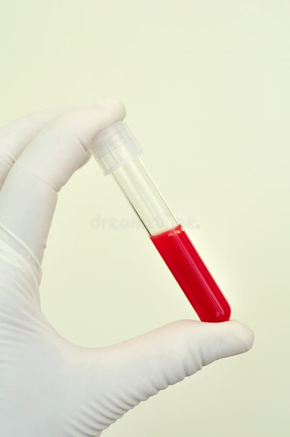 Blood sample stock image. Image of laboratory, analyzing - 21142635