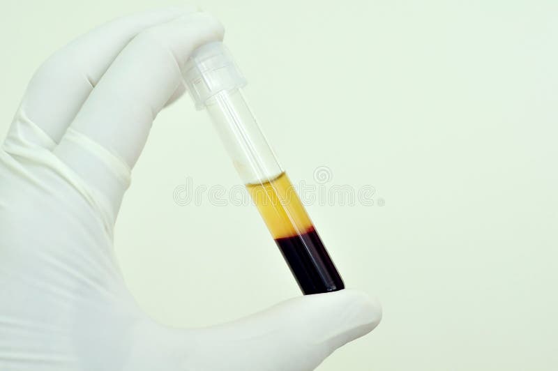 Blood sample stock image. Image of sampling, test, sample - 21142827
