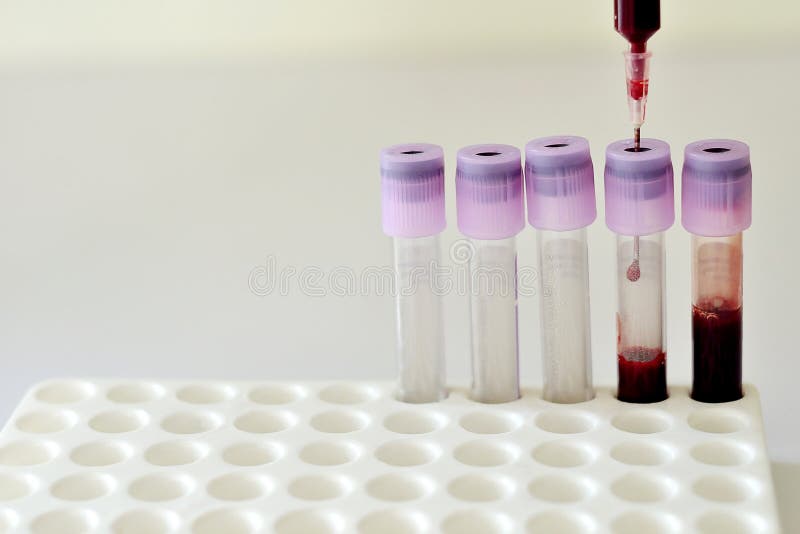 Blood transfer stock image. Image of body, voluntary - 24218313