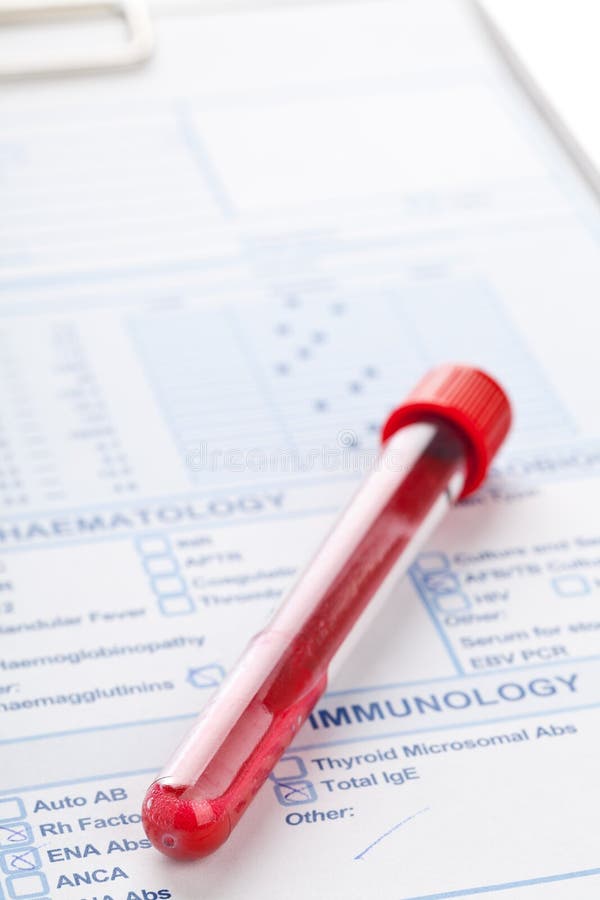 Blood sample stock photo. Image of healthcare, microbiology - 37620406