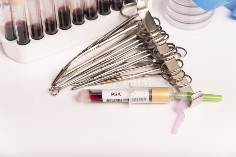 Blood Sample with Abnormal High PSA Test Result. Stock Photo - Image of ...
