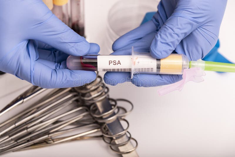 Blood Sample with Abnormal High PSA Test Result. Stock Image - Image of ...