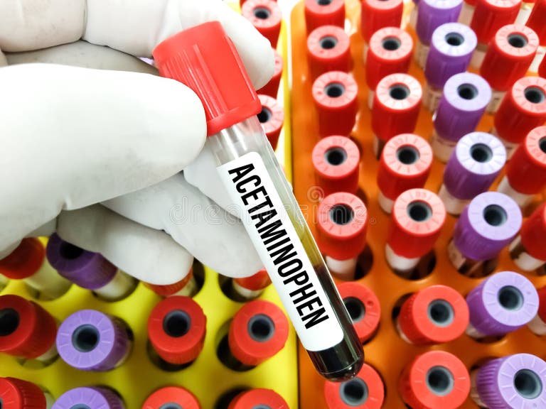 Blood Sample for Acetaminophen Test. Stock Photo - Image of immunology ...