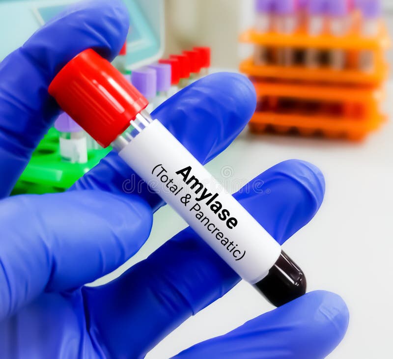 Blood Sample for Amylase (total & Pancreatic) Tesing Stock Image ...