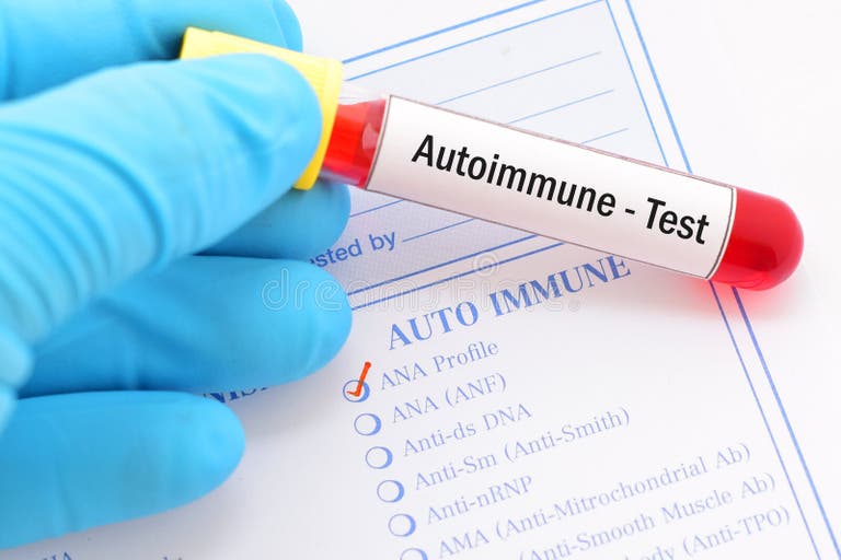 Autoimmune test stock photo. Image of blood, disease - 102023282
