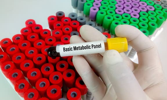 Basic metabolic panel test stock image. Image of tube - 278142449