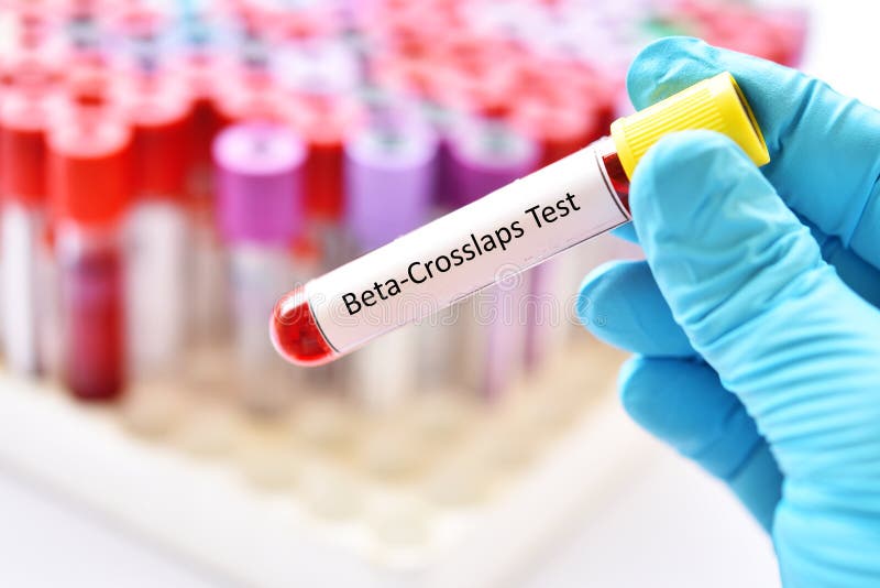 Beta hCG test stock photo. Image of report, technology - 101170516