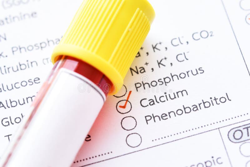 Blood Sample for Calcium Test Stock Image - Image of laboratory, exam ...