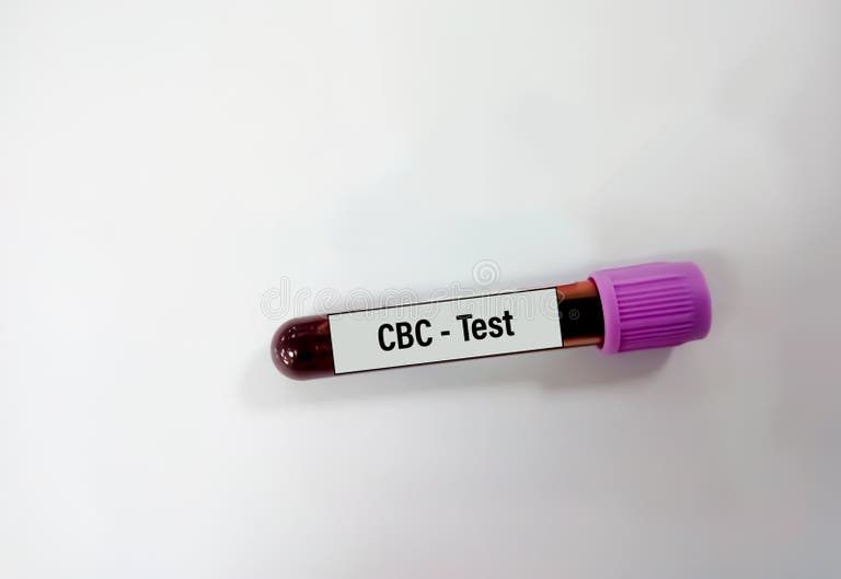Blood Sample for CBC (Complete Blood Count) Test Stock Photo - Image of ...