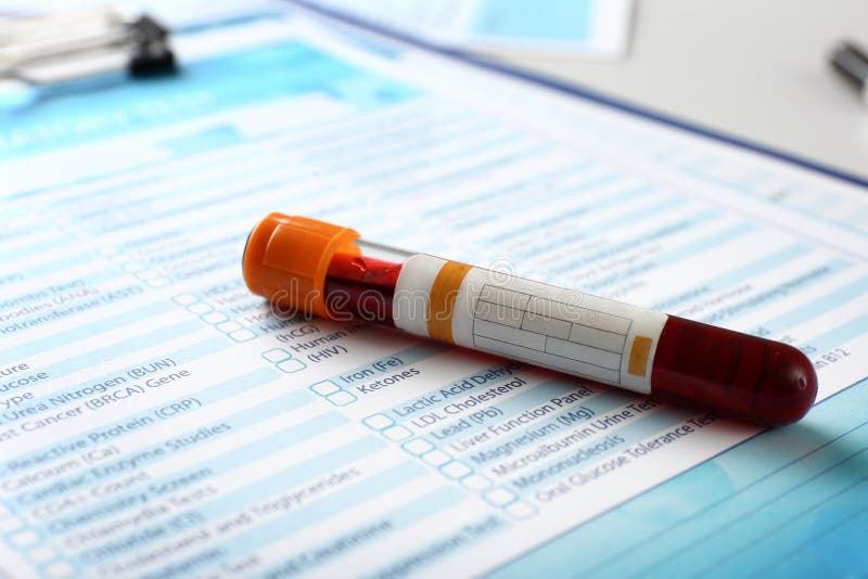 Blood Sample on Document with Result of Analyses Stock Photo - Image of ...