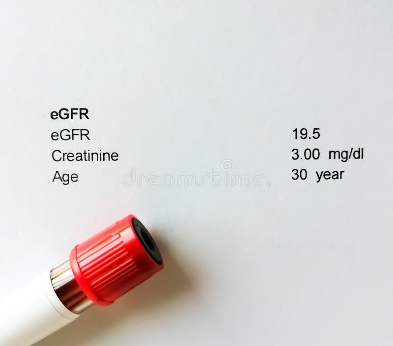 EGFR Test with Abnormal Report, CKD Stock Image - Image of heal, kidney ...