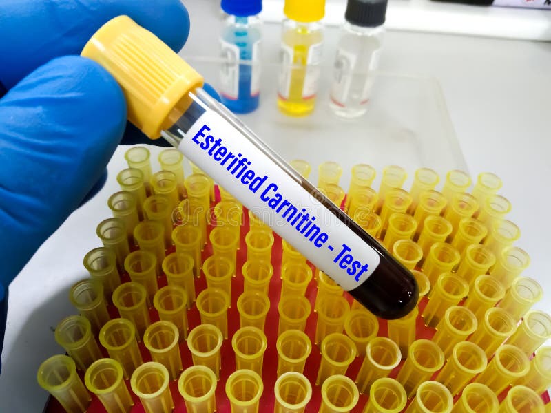 Blood Sample for Esterified Carnitine Test Stock Image - Image of ...