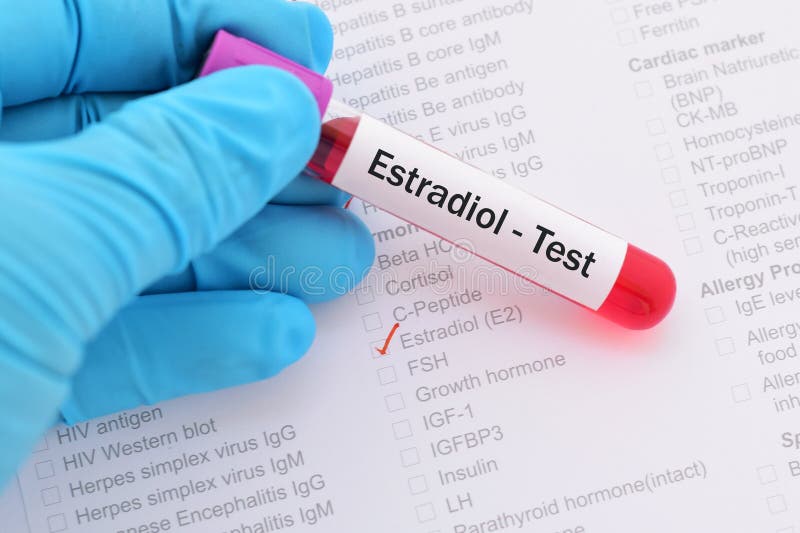 Estradiol hormone test stock photo. Image of testosterone - 109111708