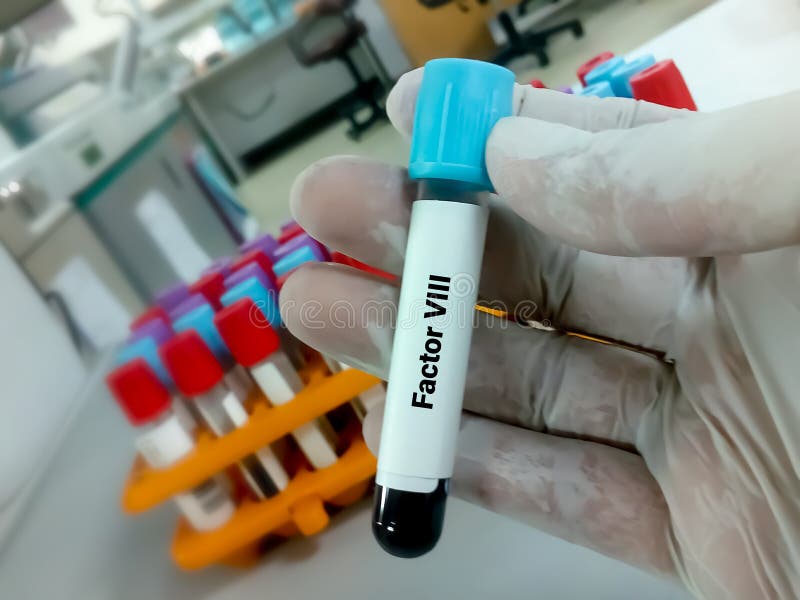Blood Sample for Factor VIII. Blood Coagulation Testing. Antihemophilia ...