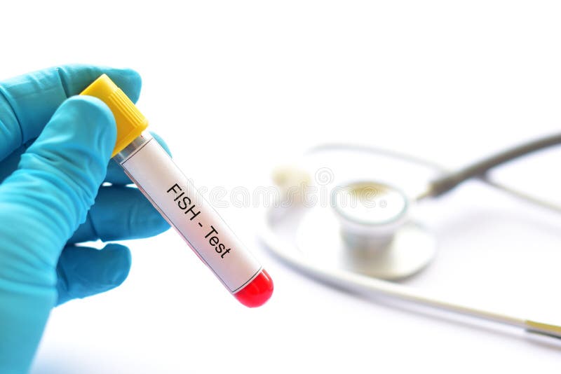 Blood sample for FISH test stock photo. Image of disorder - 126803744