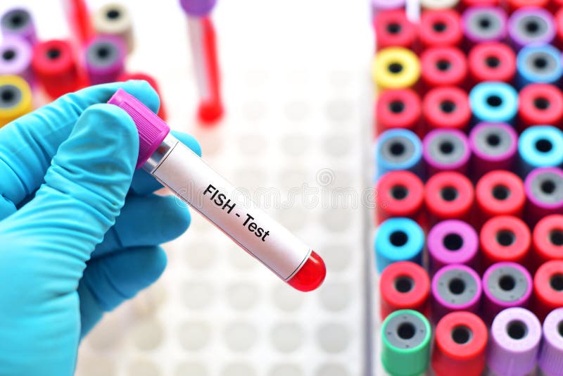 Blood sample for FISH test stock image. Image of double - 126803791