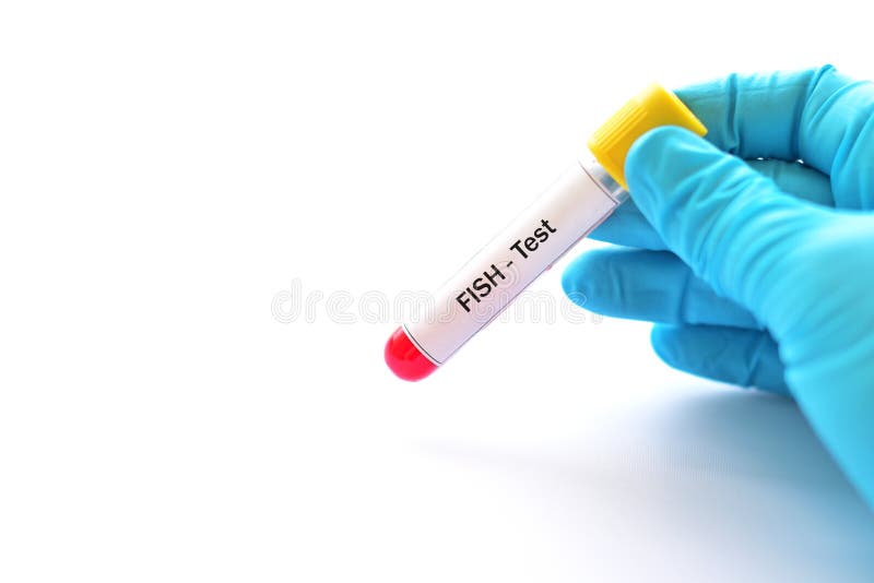 Blood sample for FISH test stock photo. Image of marker - 126803738