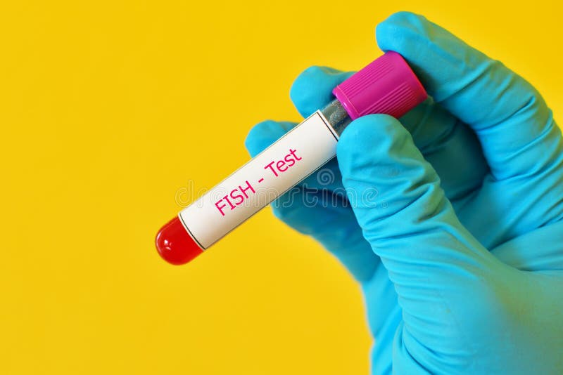 Blood sample for FISH test stock photo. Image of probe - 126803740