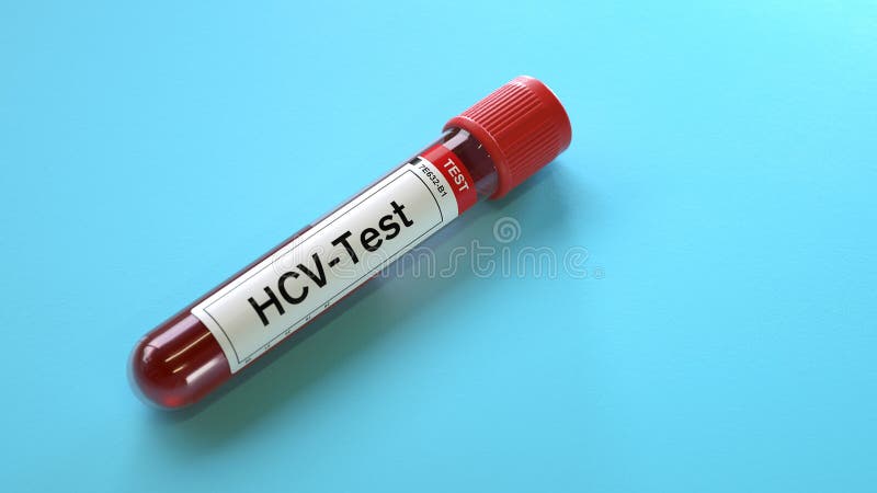 HCV virus test stock illustration. Illustration of medicine - 143031559
