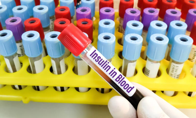 Blood Sample for Insulin Test in Laboratory Stock Image - Image of ...