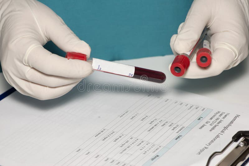 Blood Sample stock image. Image of chemistry, needle - 44574549