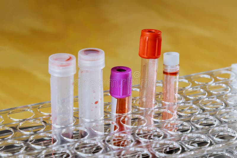 Blood Sample with Pipette and Petri Dish Others Blood Test Tubes in a ...