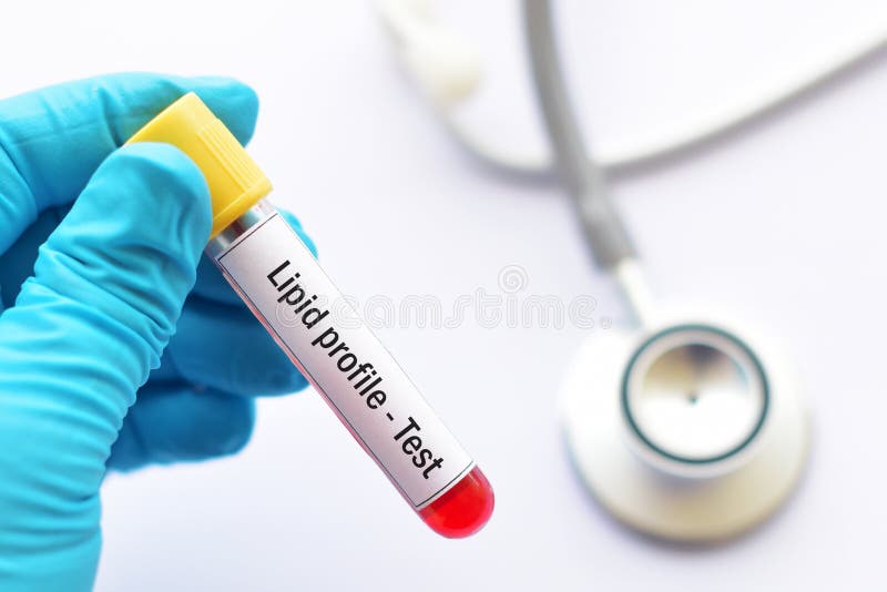 110 Hyperlipidemia Test Stock Photos - Free & Royalty-Free Stock Photos ...
