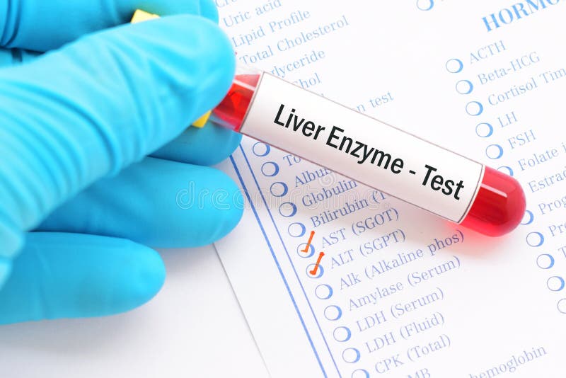 Liver enzyme test stock image. Image of medical, enzyme - 115061883